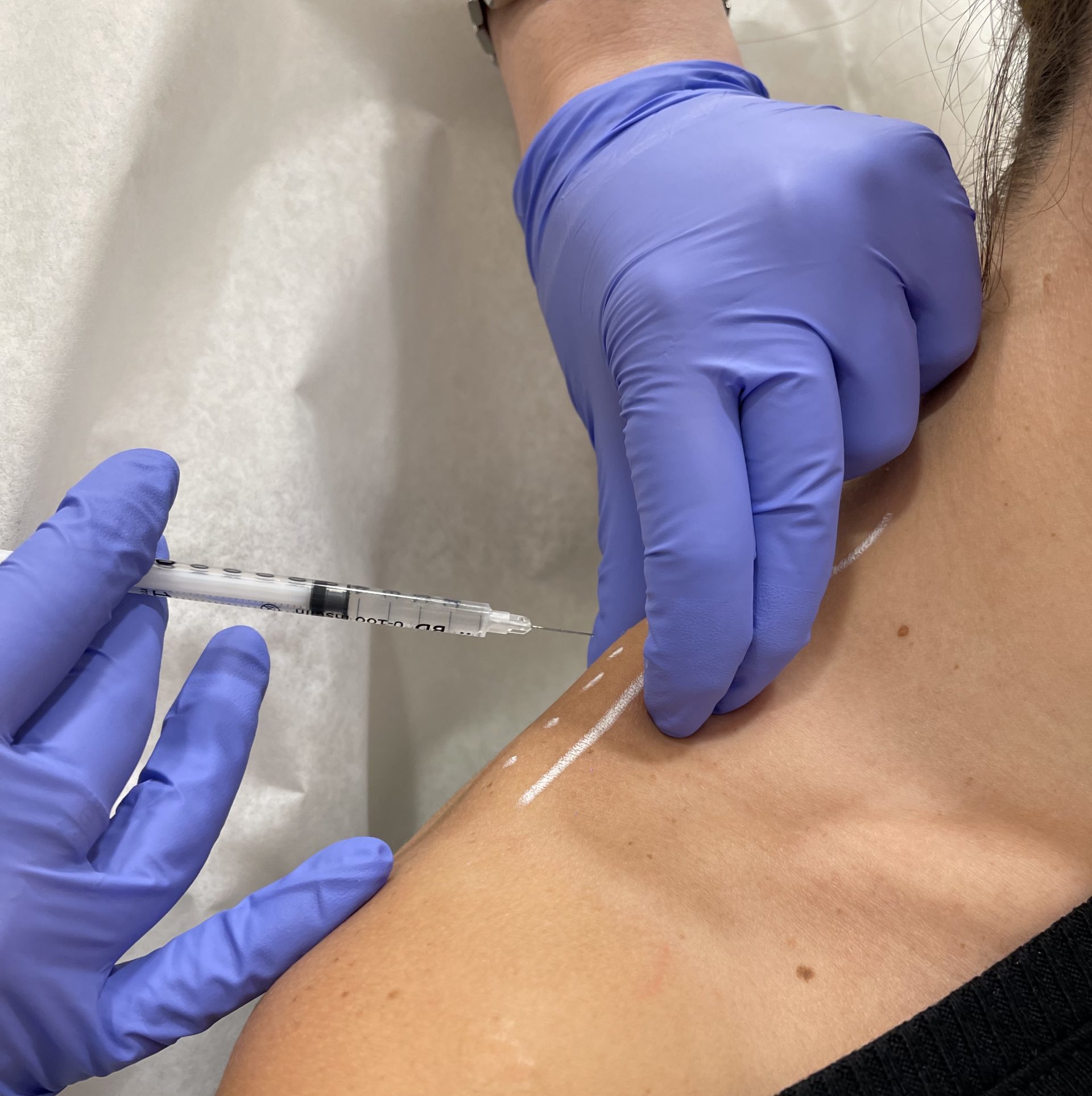 Trapezius Botox - La Chele Medical Aesthetics, LLC